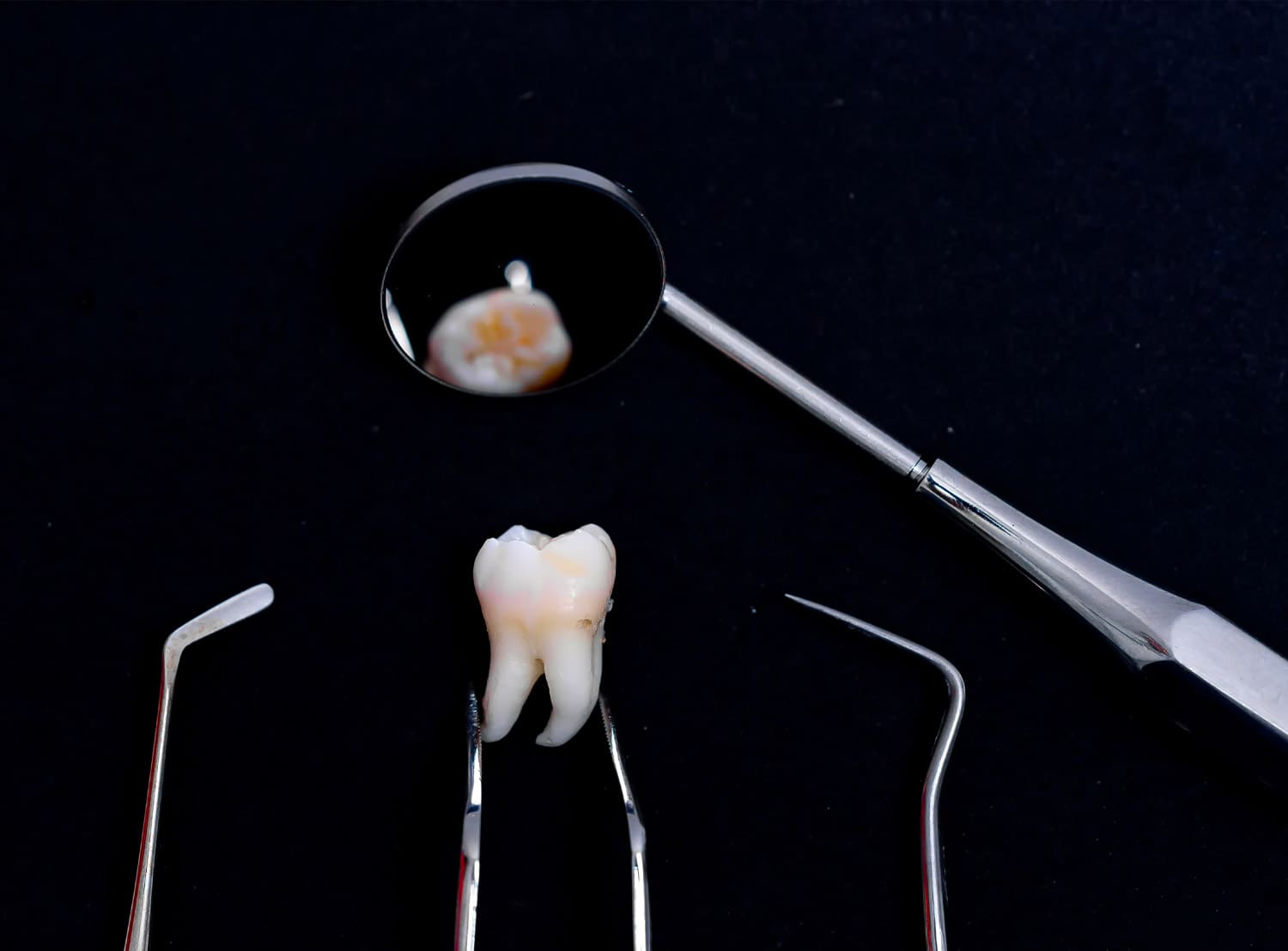 Root Canal Treatment – Whitedent Dent Clinic