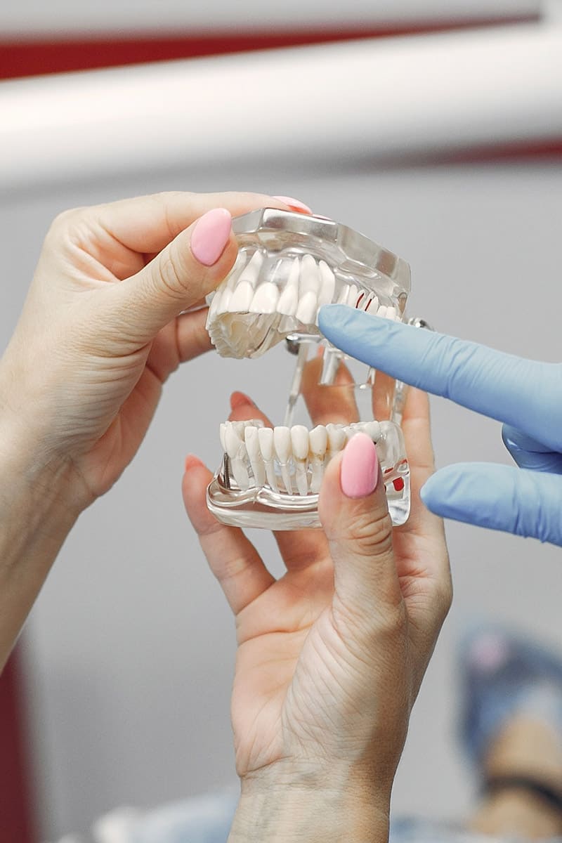 Crown and Bridge Prosthesis – Whitedent Dent Clinic